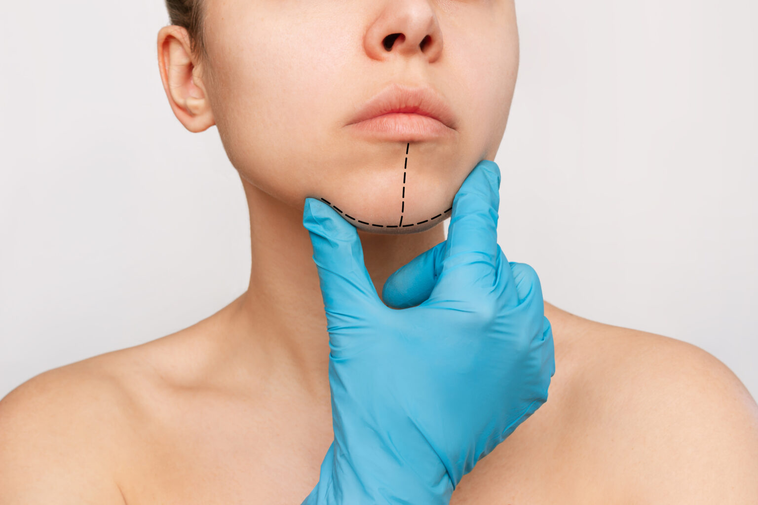 best-double-chin-reduction-treatment-in-varanasi